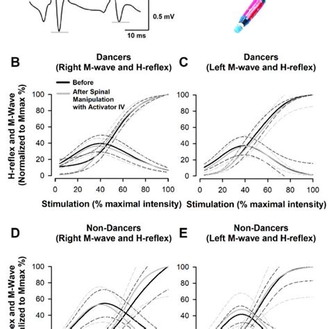 A Typical Recording Of An M Wave And H Reflex And An Illustration Of Download Scientific