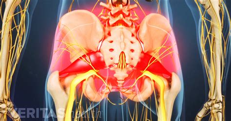 Symptoms And Diagnosis Of Piriformis Syndrome