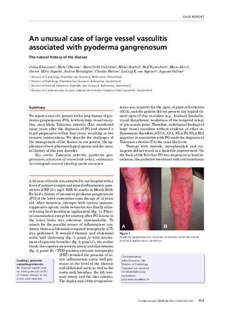 Pdf An Unusual Case Of Large Vessel Vasculitis Associated With Pyoderma Gangrenosum The
