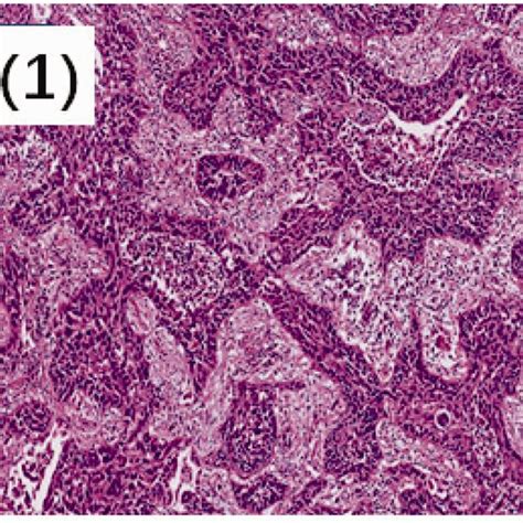 Esophagogastroduodenoscopy And Histopathologic Examination A