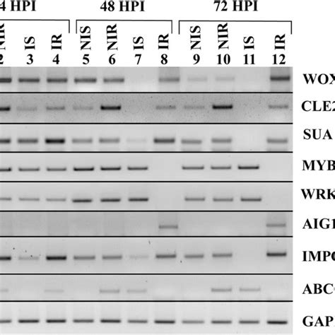 Semi Quantitative Reverse Transcriptase Pcr Amplification Patterns Of