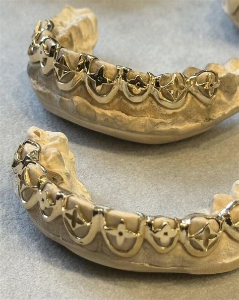 Grillz At Pharrells Lv Fw24 Show R Camronspinkfurcoat