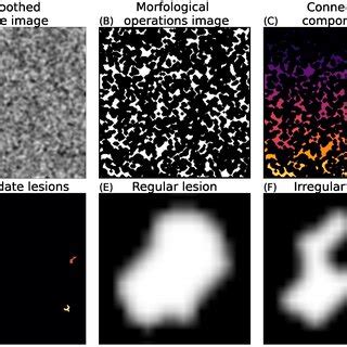 Steps To Create Lesions A A Gaussian Smoothing Filter With Radius 2 Download Scientific