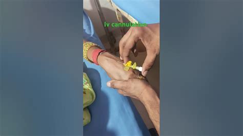 Iv Cannulation Process Youtube