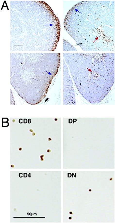 Runx3 And Runx1 Are Required For Cd8 T Cell Development During