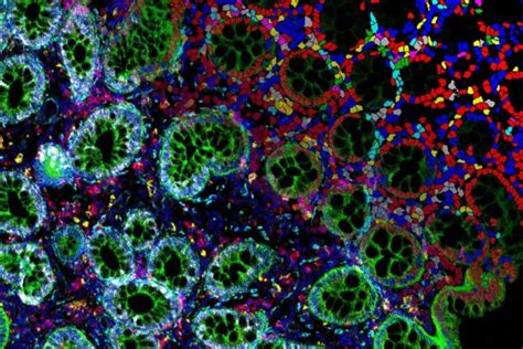 Multi Scale Spatial Omics Platform Research At Umc Utrecht