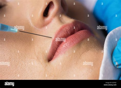 Woman Receiving Botox Injection On Her Lips Stock Photo Alamy
