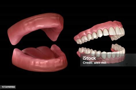 상악 및 하악 보철 인공 틀니 인간의 치아와 의치의 의학적으로 정확한 3d 그림 Edentulous에 대한 스톡 사진 및 기타 이미지 Edentulous 건강관리와