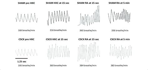 Example Traces Of Respiratory Waveforms During Various Stages Of The Download Scientific