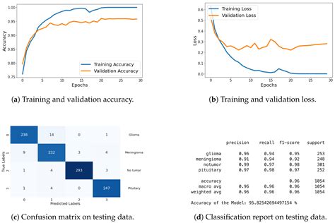 A Unified Pipeline For Simultaneous Brain Tumor Classification And Segmentation Using Fine Tuned