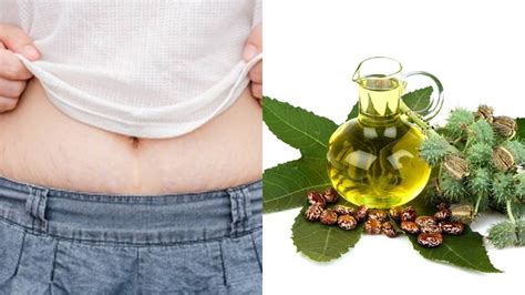 stretch marks Try Caster Oil Like This To Remove Strech Marks strech marks ആവണകകണണ പരയഗ