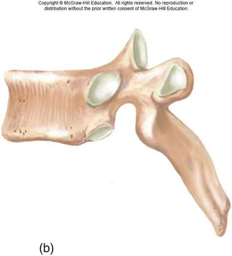 Thoracic Vertebra Lateral View