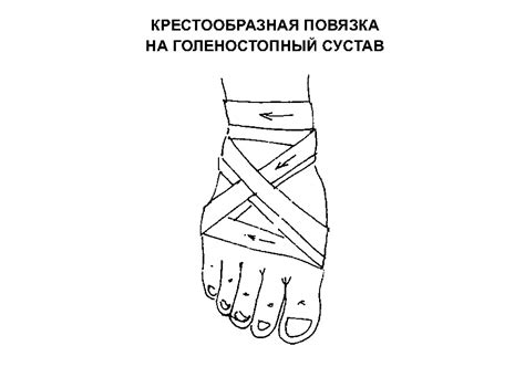 Повязка на голеностоп: правильное наложение, показания