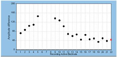Fundamentals Of Clinical ECAP Measures In Cochlear Implants Part Measurement Techniques And