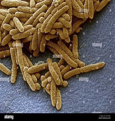 E Coli Bacteria Coloured Scanning Electron Micrograph Sem Of A Colony Of Escherichia Coli