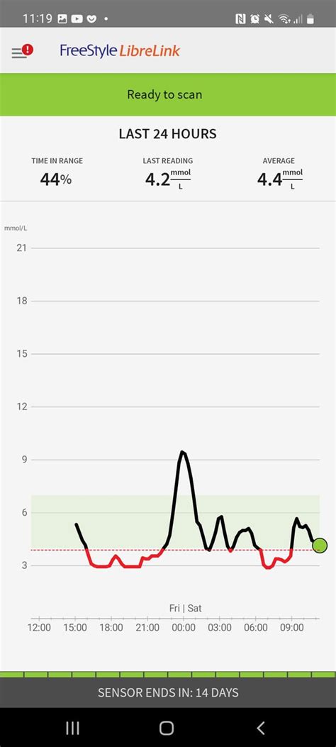I Cant Wake Up To Dexcom Alarms R Type1diabetes