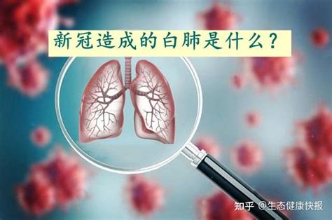 维兰尼梅奥医学科普新冠造成的白肺是什么 知乎