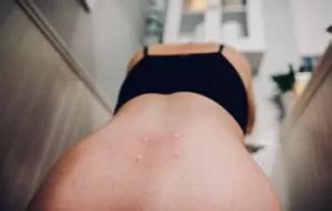 Factsheet Exploring Sterile Water Injections In Labour All Birth