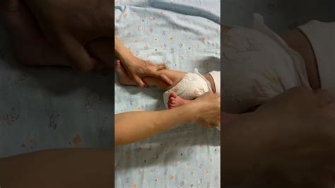 Дисплазияға массаж жасау Массаж дисплазии тазобедренного сустава Youtube