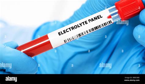 Electrolyte Panel Measures Levels Of Electrolytes Such As Sodium Potassium And Chloride Which