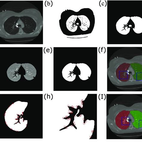 Pdf Automatic Lung Segmentation For The Inclusion Of Juxtapleural