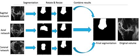 GitHub Brendan0403 BonesSegmentation Bones Segmentation By Deep Learning