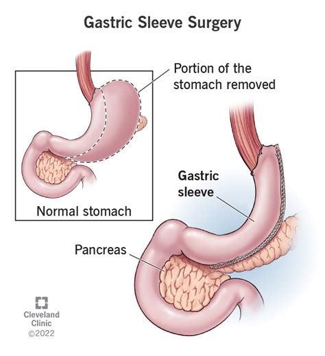 Sleeve Ứng Dụng Và Ý Nghĩa Trong Xây Dựng Thời Trang Và Thể Thao