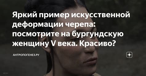 Яркий пример искусственной деформации черепа посмотрите на бургундскую женщину V века Красиво