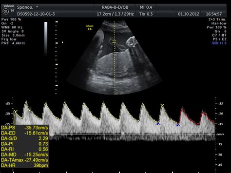 αποστόλης σταύρου μαιευτήρας γυναικολόγος