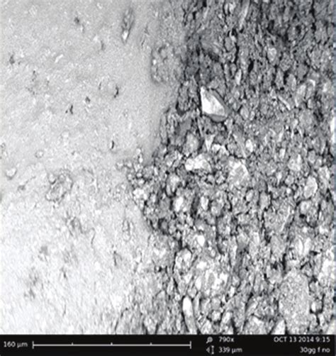 Sem Microleakage Between Mta And Bonding Agents The Mta Use Could In Download Scientific