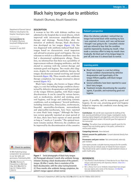 Black Hairy Tongue Due To Antibiotics Bmj Case Reports