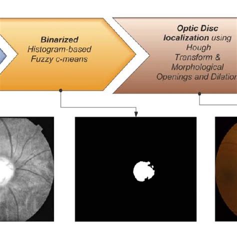 Major Stages Of Optic Disc Roi Extraction Technique Download