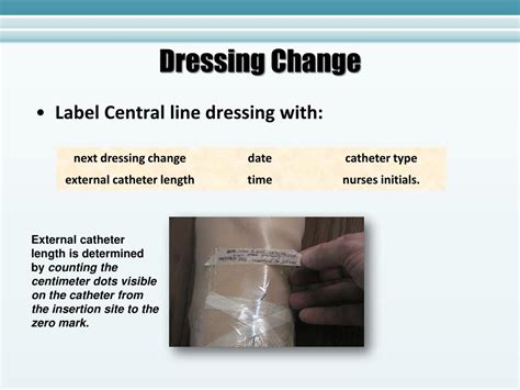 Ppt Central Lines Patient Safety Considerations Powerpoint