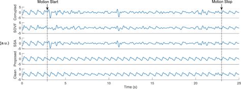 Figure 10 From Stochastic Modeling Based Nonlinear Bayesian Filtering For Photoplethysmography