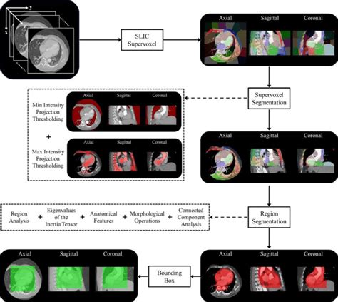 Flow Chart Of The Proposed Bounding Box Detection Algorithm Based On Download Scientific