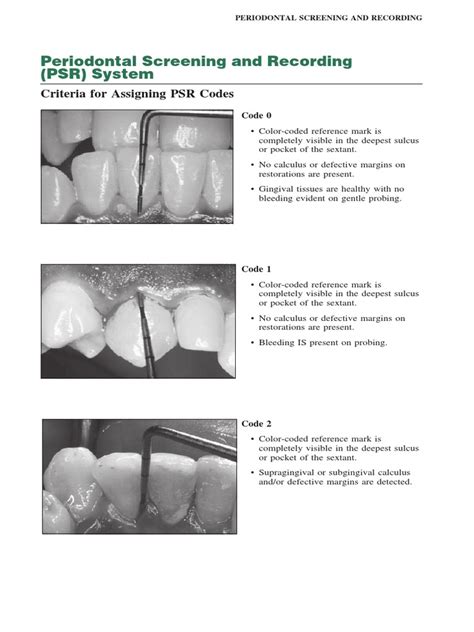 Periodontal Screening And Recording Psr System Criteria For Assigning Psr Codes Pdf
