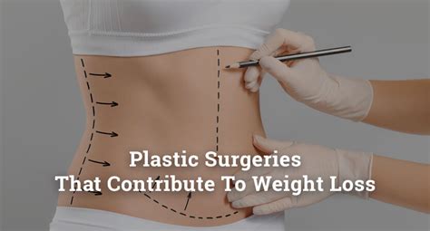 4 Plastic Surgeries That Contribute To Weight Loss Aventus