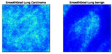 Attention Visualization Of Images Employing Gradcam For Activation Maps Download Scientific