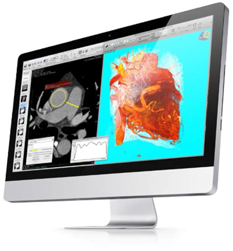 osirix dicom viewer osirix md