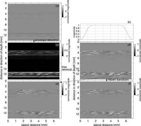 A Radio Frequency Echoes From The Phantom B Tukey Window Used For