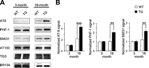 Age Dependent Increase In Tau Hyperphosphorylation At The At8 And Phf 1