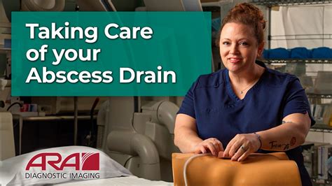 Taking Care Of Your Abscess Drain Ara Diagnostic Imaging