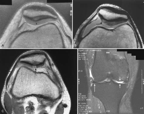 Anatomy Musculoskeletal Key