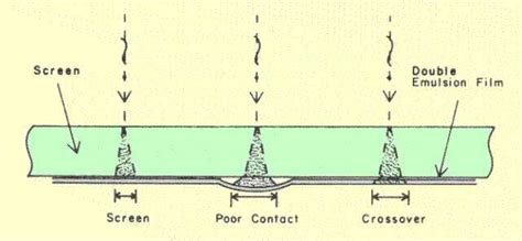 Radiology Film Screen Cassette