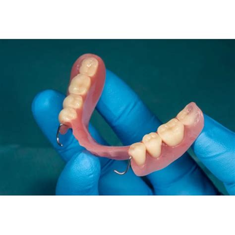 Частична протеза