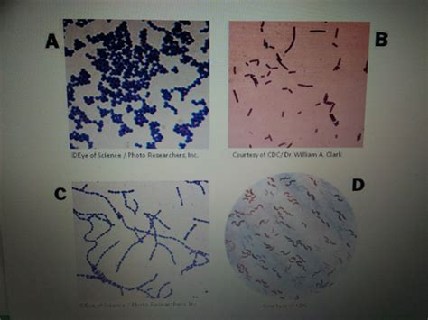 Staining Flashcards Quizlet