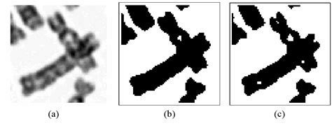 Figure 1 From Segmentation Of Overlapping Chromosome Images Using