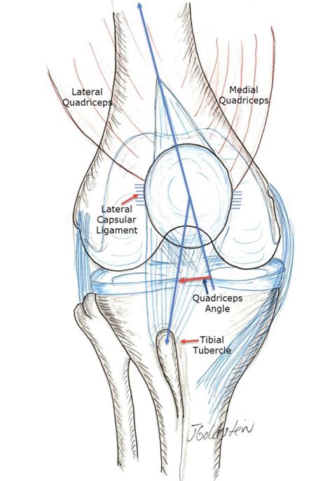 Patellar Maltracking And Patellar Realignment Anteromedialization