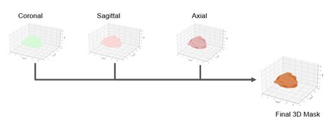 GitHub Amalmsaleem Lung Nodule Quantification
