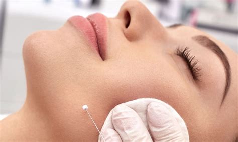 How Does Threading Facelift Work Diaminy Medical Aesthetics